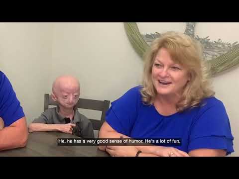 Family shares their Progeria journey