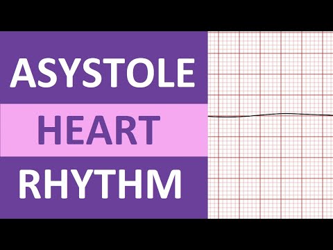 Asystole ECG/EKG Quiz Questions