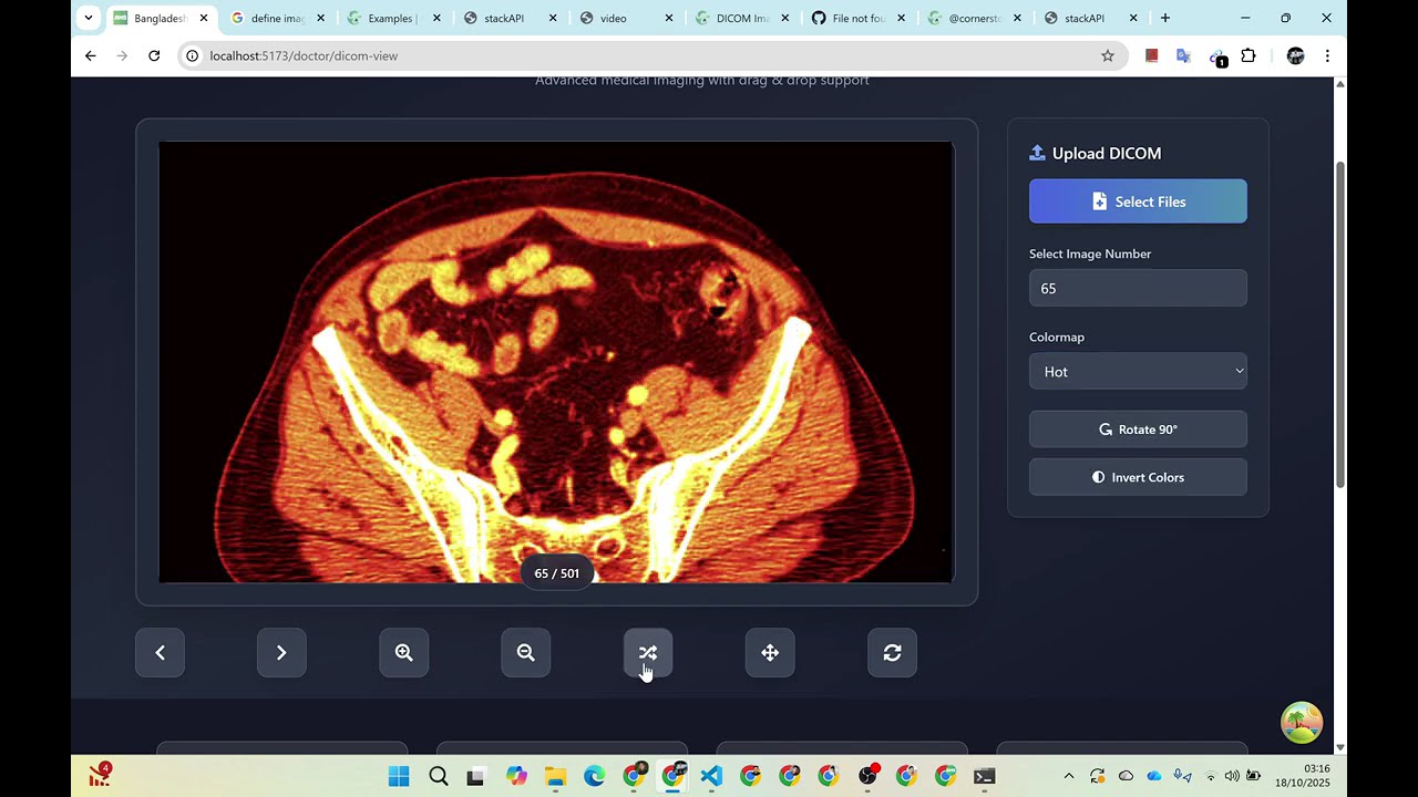 Excited to share a major update on my dissertation project, bangladesh health service.