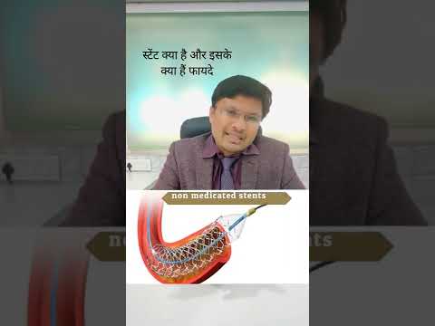 स्टेंट क्या है और इसके क्या हैं फायदे?"Unveiling Stents: Empowering Hearts and Saving Lives"
