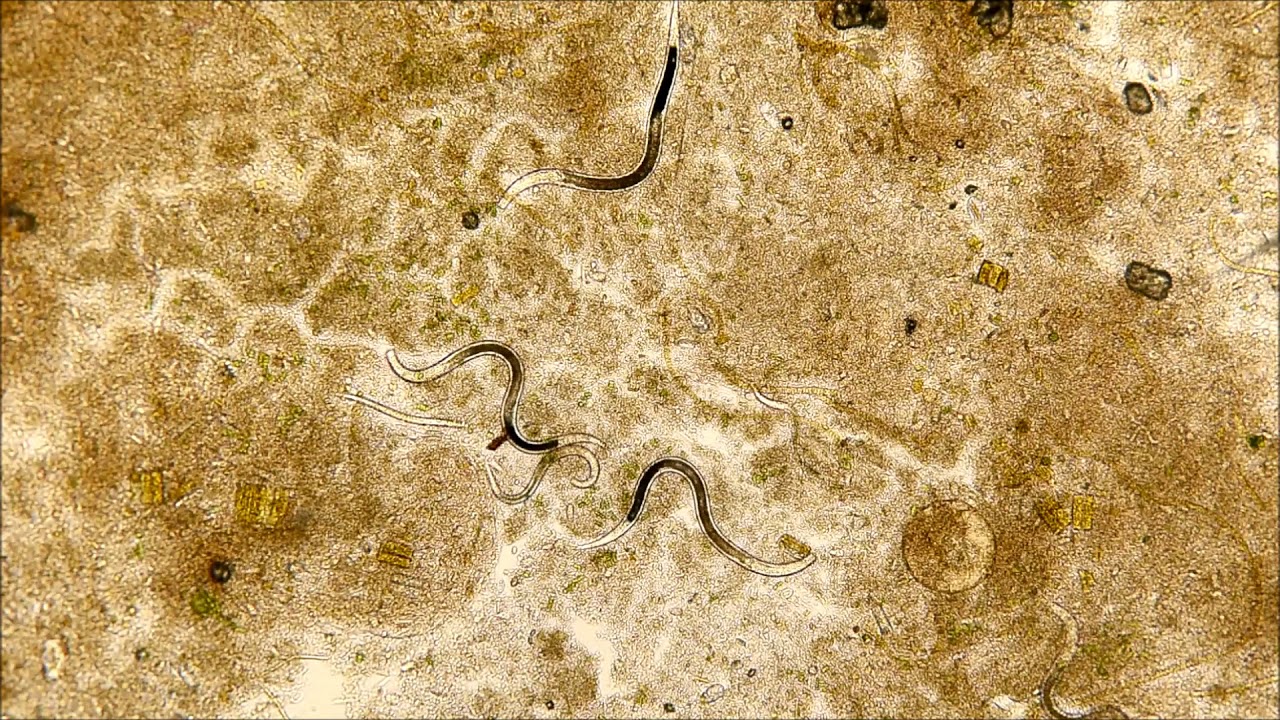 Nematode Worms 100x Microscope