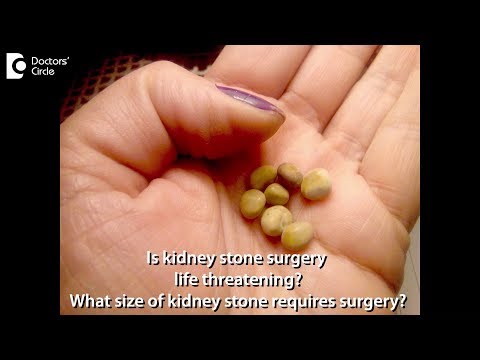 Is kidney stone surgery life threatening What size of kidney stone requires surgery? -Dr. Manohar T