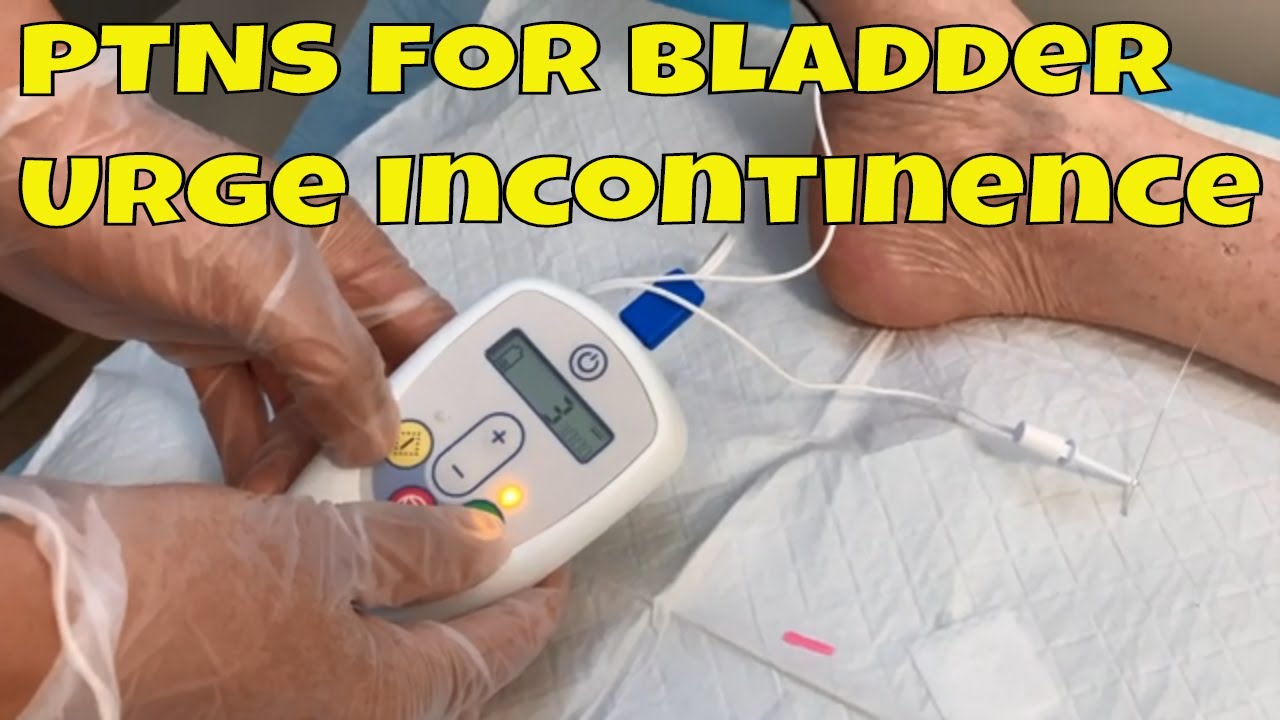Percutaneous Tibial Nerve Stimulation for Overactive Bladder