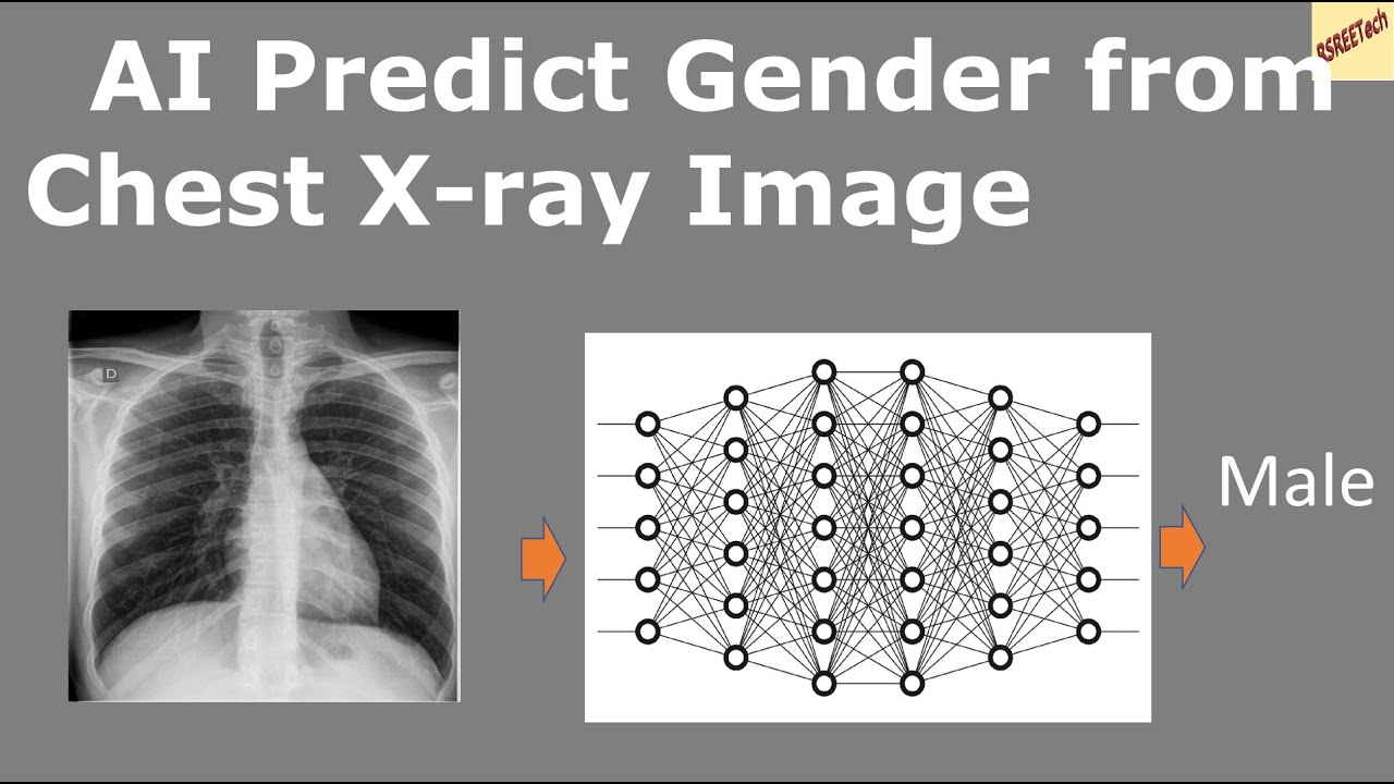 Predict Gender from Chest X-ray Image. Deep Learning EfficientNet Kaggle notebook walkthrough