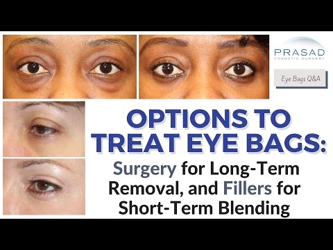 Options to Reduce Eye Bags - Long-Term Surgical Removal, and Short-Term Blending with Fillers