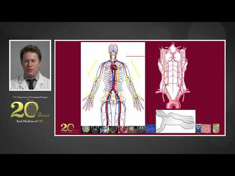 Management of Intracranial Occlusive Disease