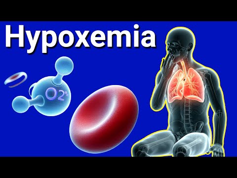 7 Hidden signs of Hypoxemia (Low Bloos Oxigen)