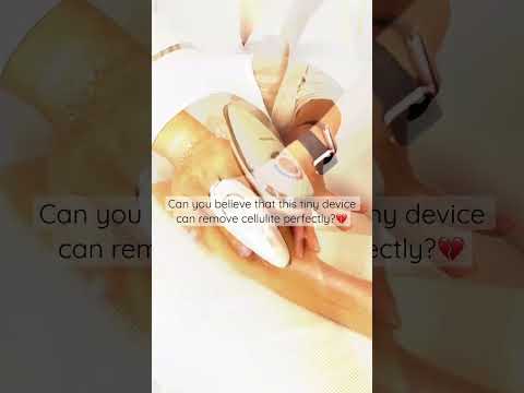 #cellulitetreatment #cellulite #bodycontouring