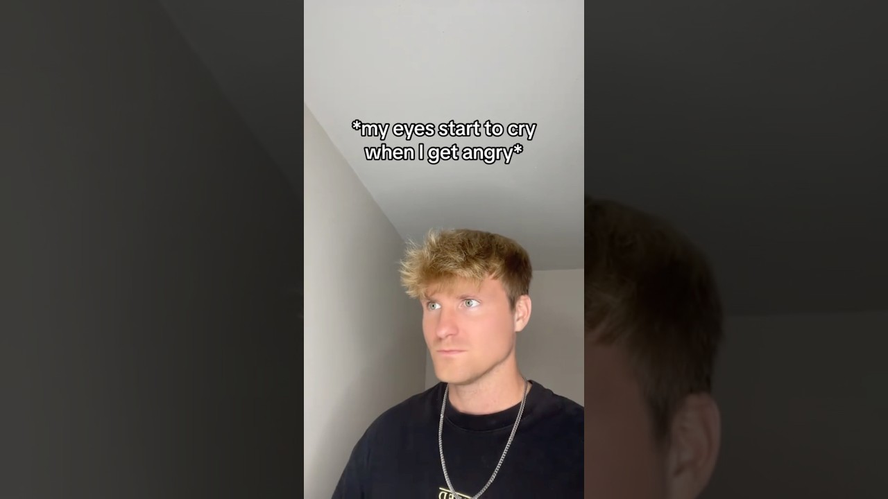 When your eyes start to cry when you get angry.. #shorts #foryou #viral
