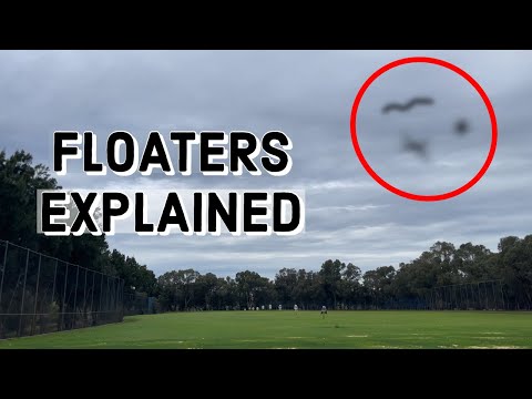Watch this if you have floaters
