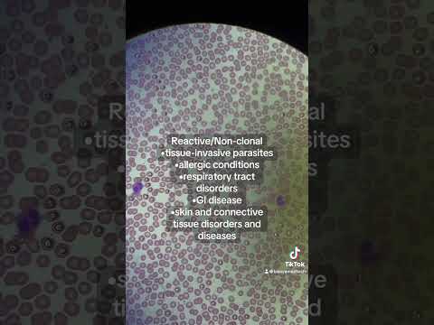Eosinophils in the peripheral blood. #foryou #medtech #shortvideo #shorts
