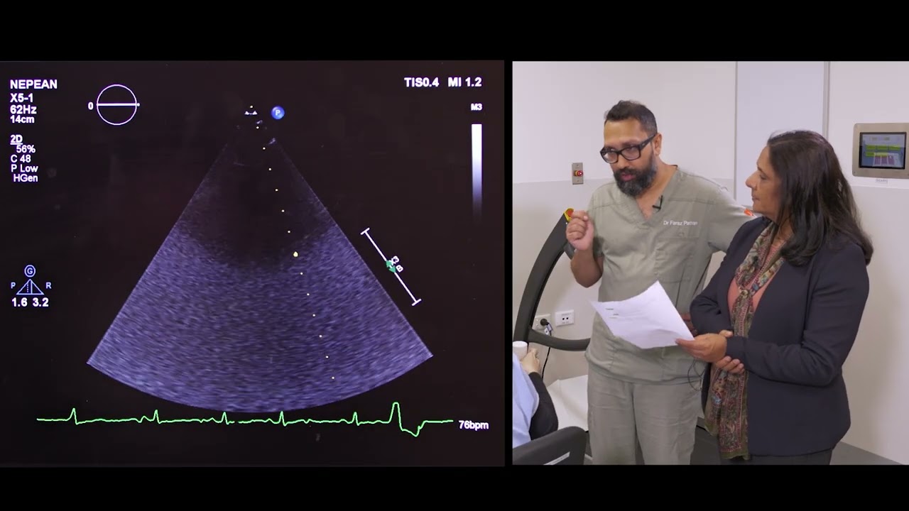 Transthoracic Echocardiogram Protocol