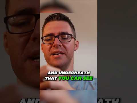 Second Toe Pain: Can Be A Real Pain In The Foot!