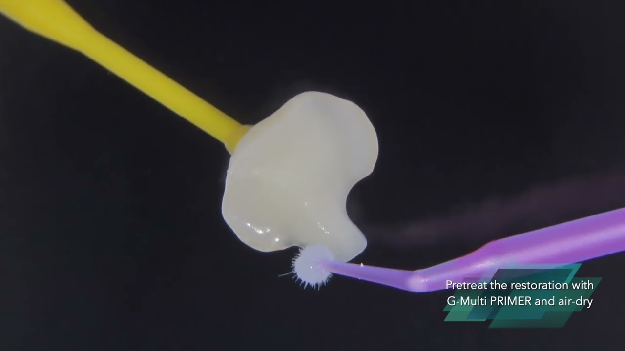 GC Indirect Restorative Solutions - Luting