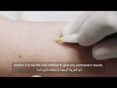 What is Electrolysis - FAQ #1