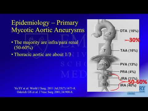 Mycotic Aortic Aneurysms