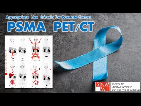 PSMA PET/CT Imaging | Appropriate Use Criteria | SNMMI