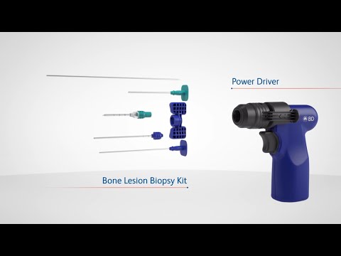 BD Trek™ Powered Bone Biopsy System: Bone Lesion Procedural Video