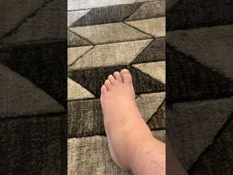 It hurts so bad