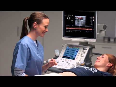 Elevate efficiency with the Aplio 500 Platinum system