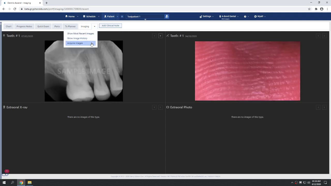 Digital Doc Blū Sensor Integration for Dentrix Ascend