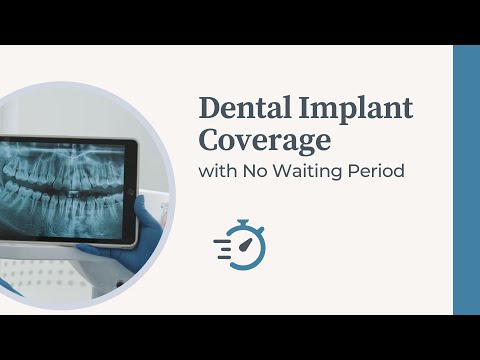 Dental Insurance That Covers Implants with No Waiting Period | Spirit Dental & Vision