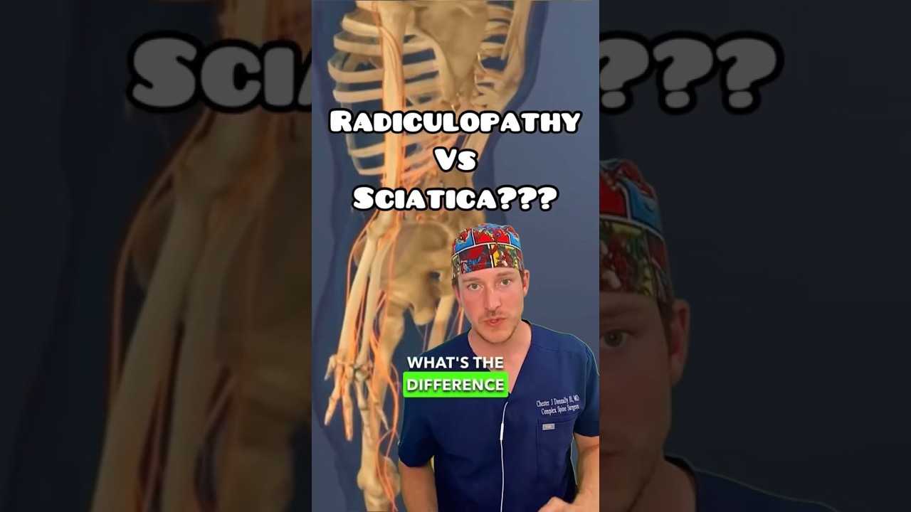 What’s the difference between RADICULOPATHY and SCIATICA? ￼🤓⚡️⚡️⚡️👎