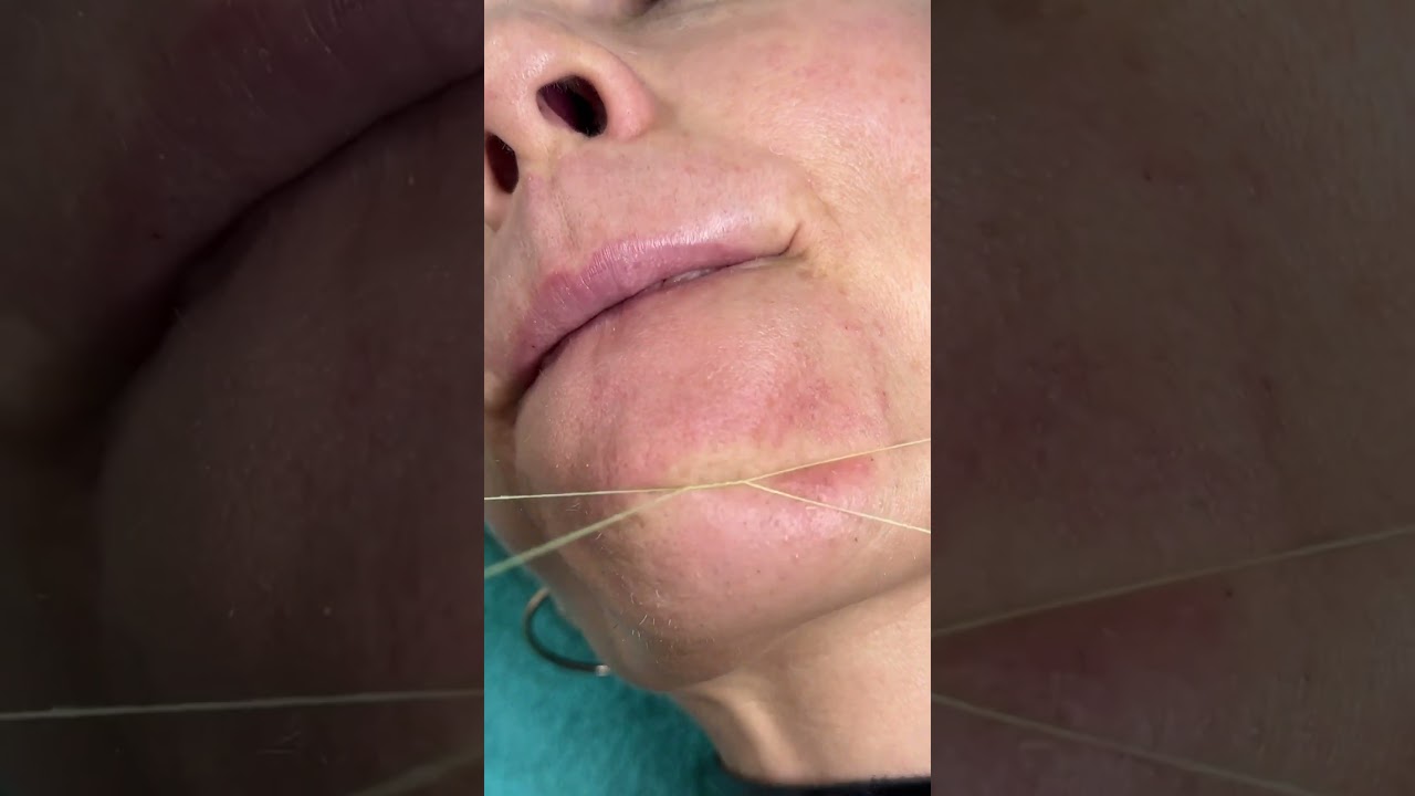 Chin Threading                               #threading #facethreading #threadingtutorial