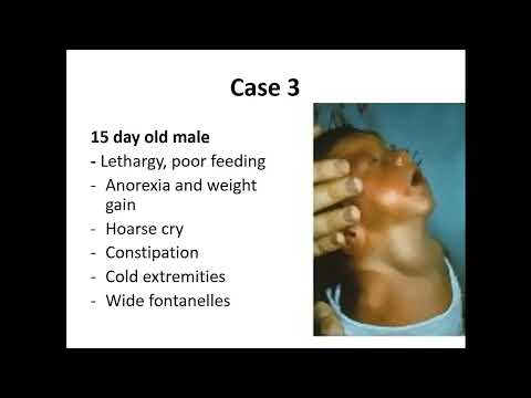 Thyroid disorders Prof Nora Badawi