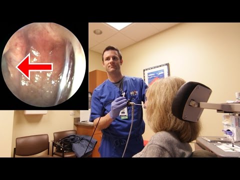 Nasal Endoscopy