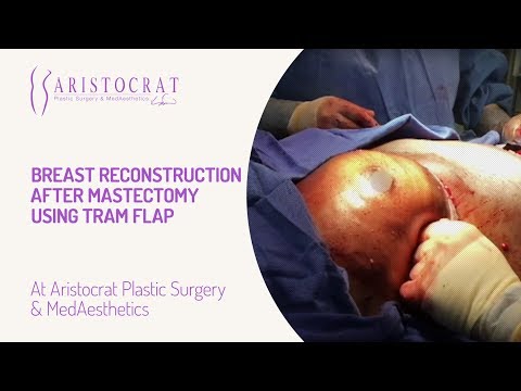 Breast Reconstruction after Mastectomy using TRAM Flap
