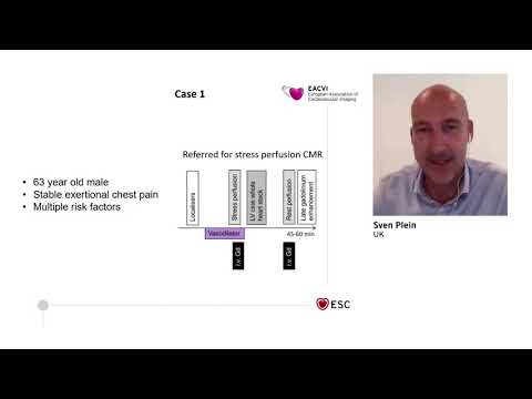 EACVI free webinar: Absolute quantification of myocardial perfusion