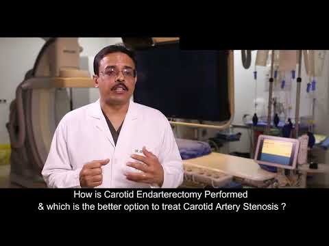 How is Carotid Endarterectomy Performed ?