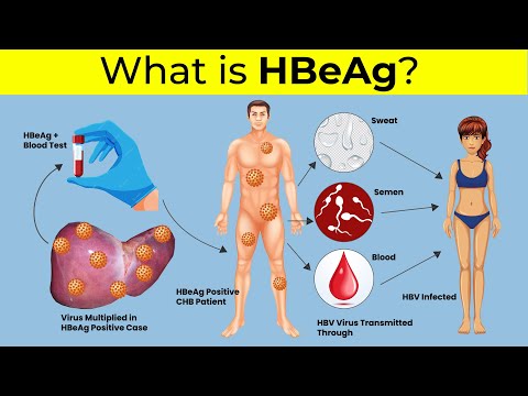 Hepatitis B e Antigen | HBeAg | Hbeag Negative Treatment | Hepatitis | Hepatitis B