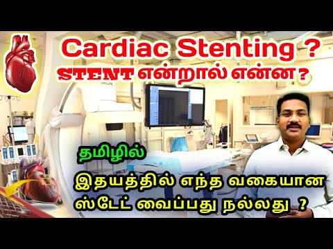 Cardiac Stent in Tamil | heart stent | Angioplasty Angiogram|Drug eluting stent | balloon CAG
