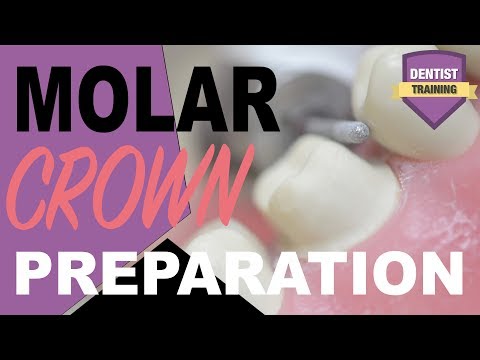 Molar Crown Preparation | Dental Crown Techniques