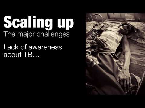 Can we conquer tuberculosis? | Shelly Batra | TEDxWBG