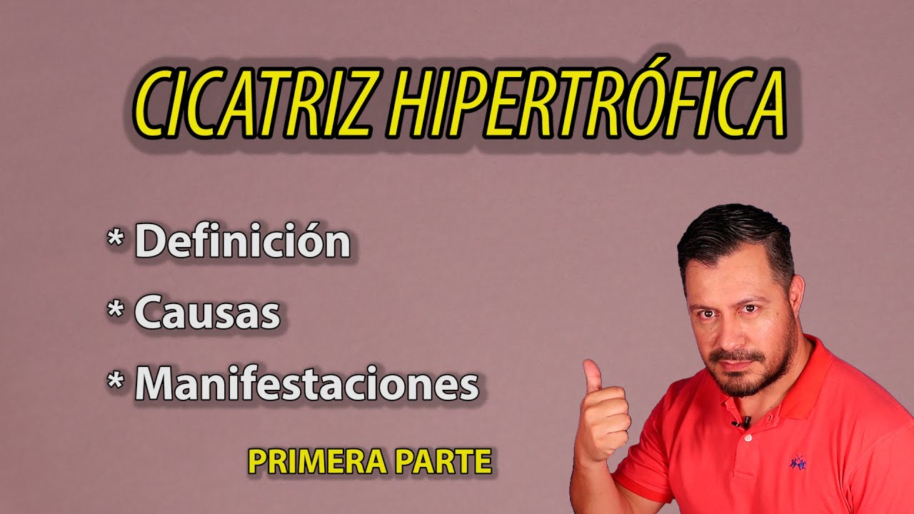 💥 CICATRIZ Hipertrófica | Qué es?. PARTE 1.