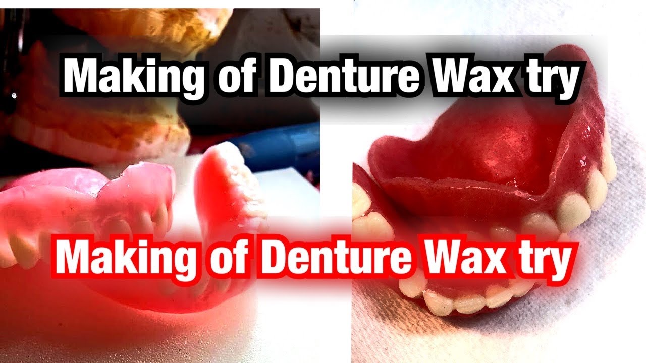 Making Dentures,  Wax Trying