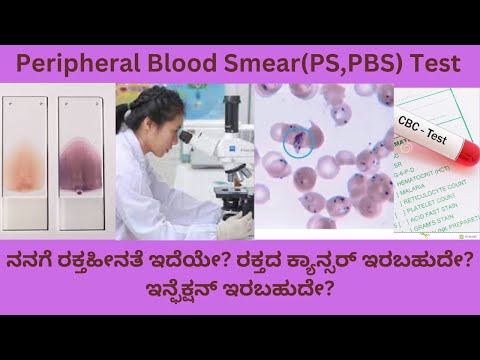 Peripheral blood smear(PS,PBS,PS for MP) test in kannada uses indications and report interpretation