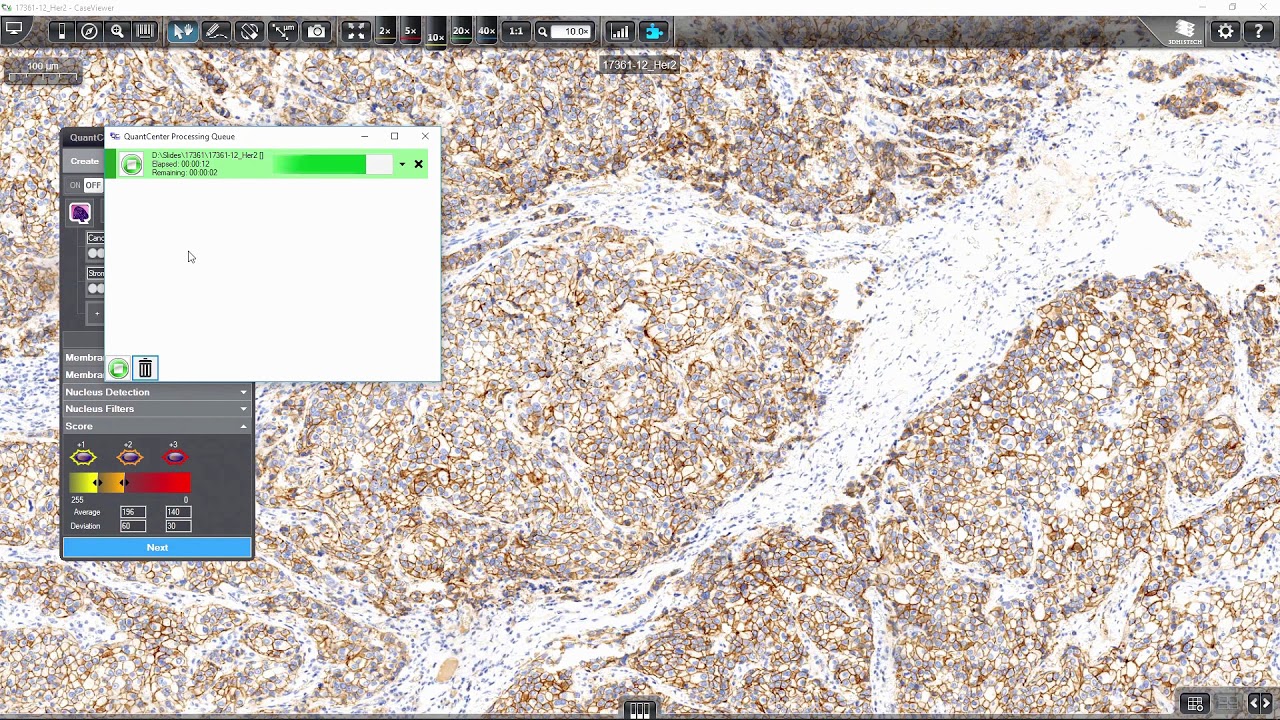 3DHISTECH - Her2stain quantification using PatternQuant and MembraneQuant