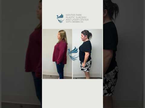 Medical Weight Loss Results | Winter Park & Orlando