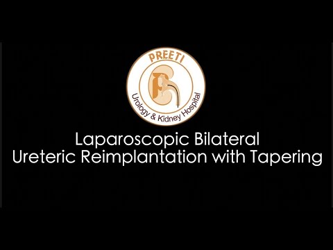 Laparoscopic Bilateral Ureteric Reimplantation with Tapering