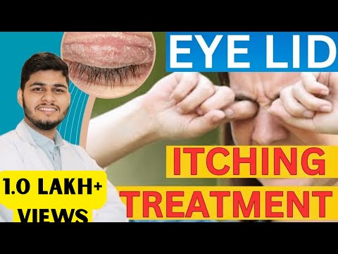 Eye Itching: Causes, Treatment, Home remedies | Itching under Eye Skin