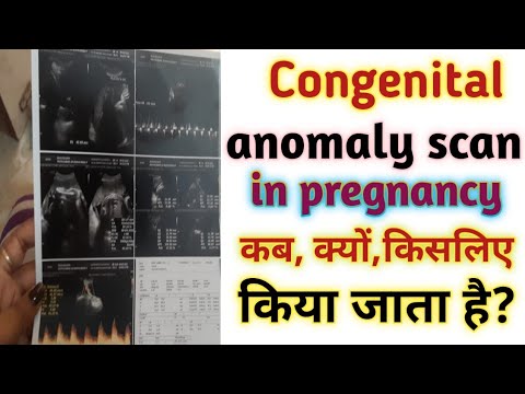 congenital anomaly scan कब और क्यो होता है? congenital anomaly scan in pregnancy in hindi!