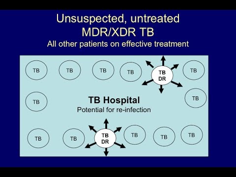 Reducing TB transmission in high-burden settings