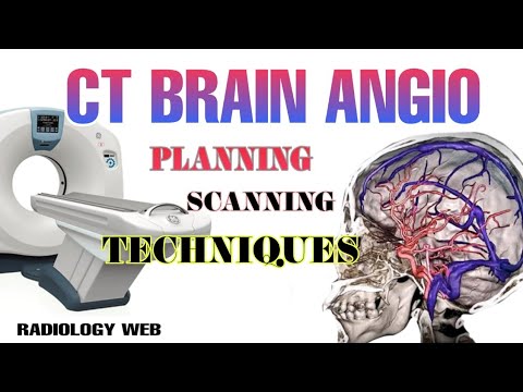 ct brain angio.. procedure, planing, technique full video
