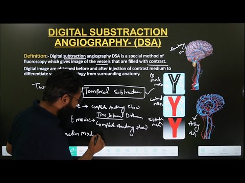 DSA || DIGITAL SUBTRACTION ANGIOGRAPHY || PRINCIPLE |PART-1| TYPE OF DSA || IN HINDI || MADE EASY |