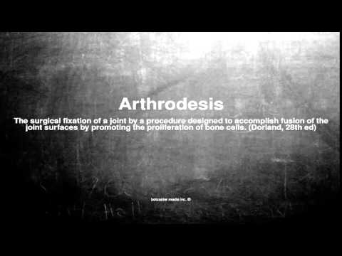 Medical vocabulary: What does Arthrodesis mean