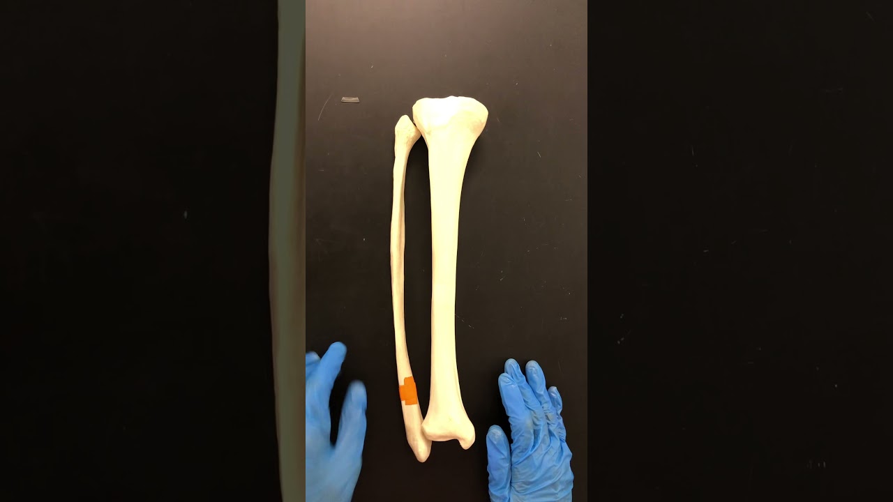 Lab  8B - fibula and tibia